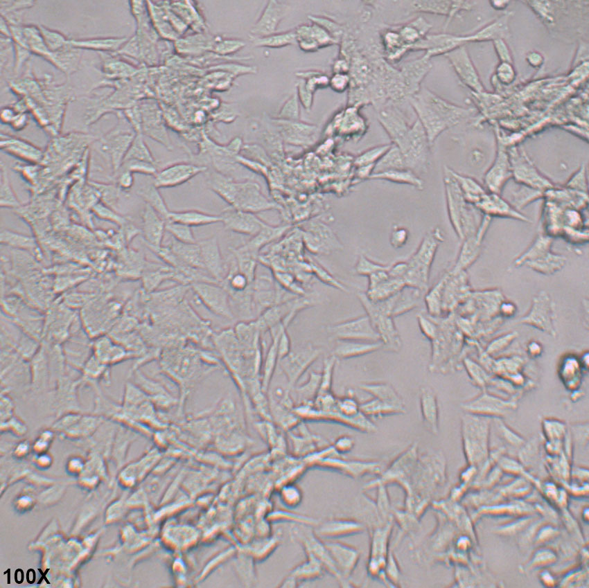 GL261 小鼠胶质瘤细胞 - 广州科珞捷生物技术有限公司-科珞捷生物聚焦于类器官（ORGANOID）技术的发展